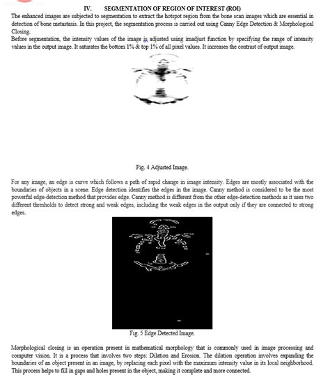 Computer Aided Detection Of Bone Metastasis Using Bone Scintigraphy Scans