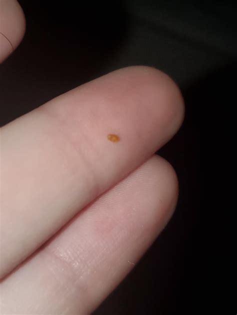 Are These Tapeworm Eggs Or Am I Paranoid Rcats