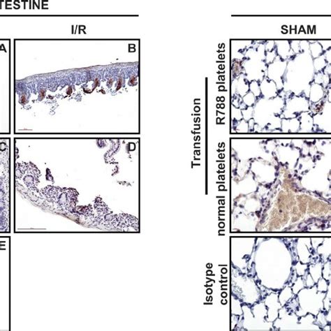 Reduced Platelet Sequestration In Lung But Not In The Intestine After