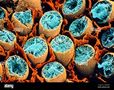 Seminiferous Tubules Coloured Scanning Electron Micrograph Sem Of Sectioned Seminiferous