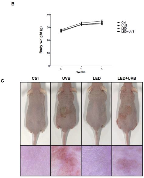 Protective Effect Of Red Light Emitting Diode Against Uv B Radiation