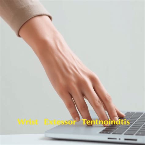 Rest And Rehab For Wrist Extensor Tendonitis Key Insights