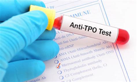 Chỉ Số Xét Nghiệm Anti Tpo 50 U Ml Có Phải Bị Bệnh Về Tuyến Giáp Không