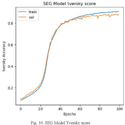 Figure 1 From Brain Tumor Detection Using Resnet Architectures Semantic Scholar