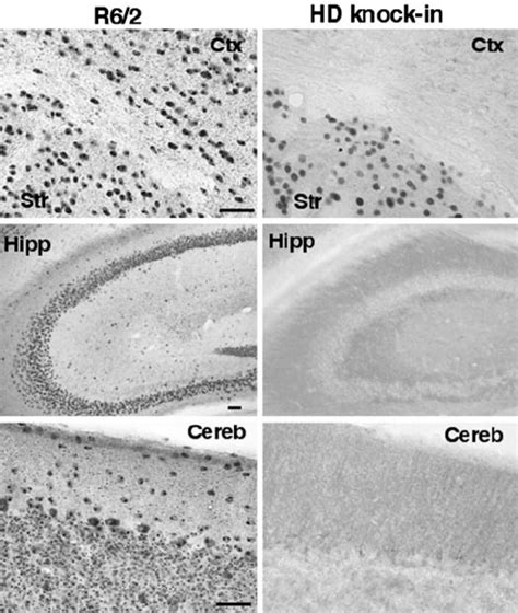 selective accumulation of nuclear huntingtin aggregates in striatal