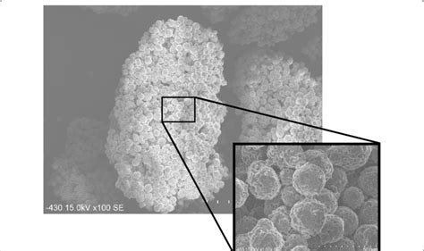 Sem Micrograph Of Hpmm β Tcp Hpmm β Tcp Is A Granular Bone Substitute Download Scientific