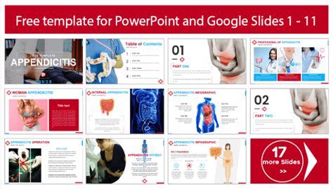 Appendicitis Symptoms And Causes Template PowerPoint Templates And Google Slides