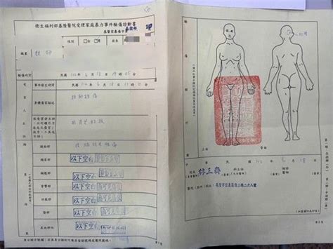 三立主播黃倩萍被控家暴 男友出示驗傷單訴訟中 Ettoday星光雲 Ettoday新聞雲