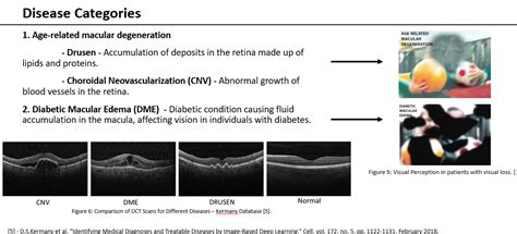 Github Tolitei Oct Image Classification This Repository Contains An