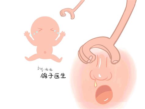 鼻梁挺起来父母不用操心你的帮忙是错的