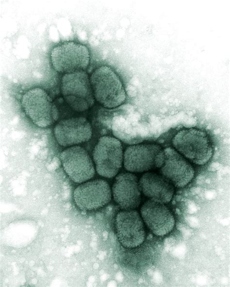 Free Picture Transmission Electron Micrograph Viruses Negative