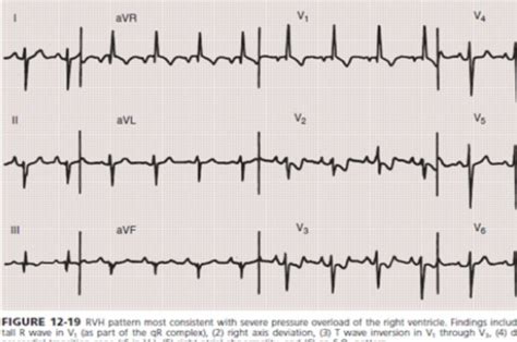 Image Hosted At ImgBB ImgBB