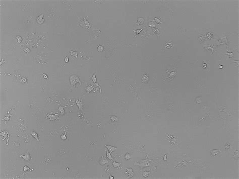 116 Questions With Answers In Thp 1 Cells Science Topic
