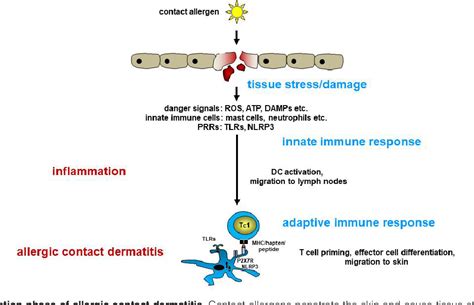 Irritant Contact Dermatitis Pathophysiology