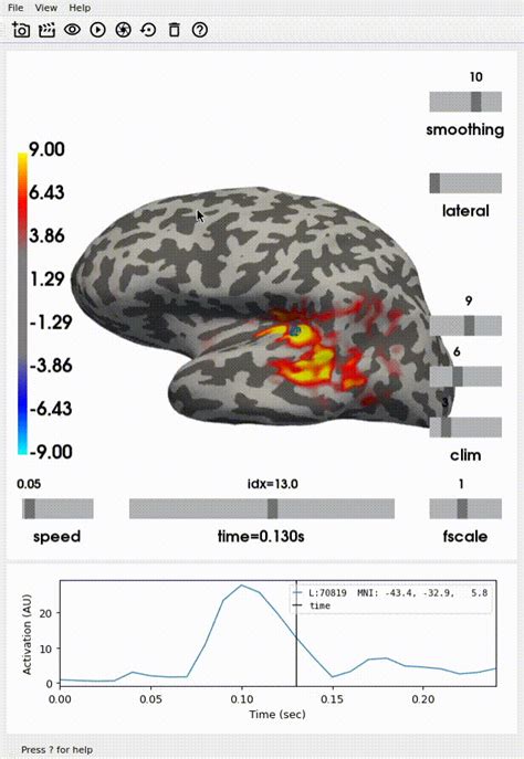 Enh New Interface For Brain · Issue 7162 · Mne Toolsmne Python · Github