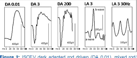 Figure 2 From Visual Electrodiagnostics And Eye Movement Recording