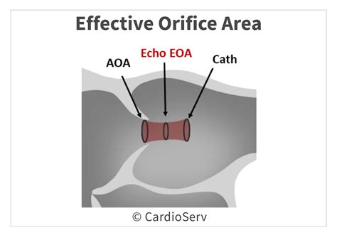 Aortic Stenosis Breaking Down The Continuity Equation Cardioserv