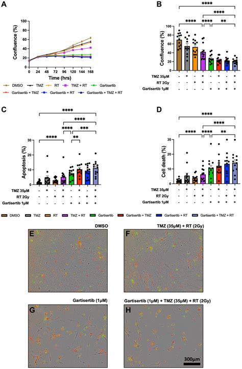 Live Cell Imaging Of Glioblastoma Cell Lines Treated With Gartisertib