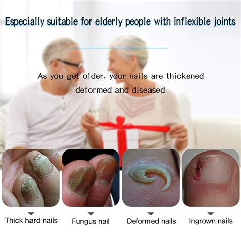 Кусачки для ногтей коррекция ногтей толстые щипцы для вросших ногтей кусачки для омертвевшей