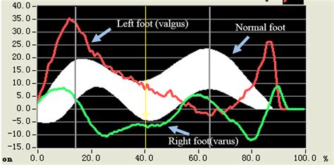 All Regions Of Plantar Pressure Curve Download Scientific Diagram