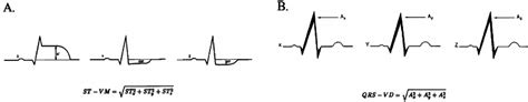Calculation Of St Vector Magnitude A And Qrs Vector Difference Download Scientific Diagram