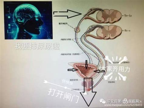 前列腺的分区示意图 腺分叶及分区 腺图 大山谷图库