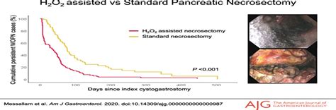 Direct Endoscopic Necrosectomy With And Without Hydrogen Per Official Journal Of The