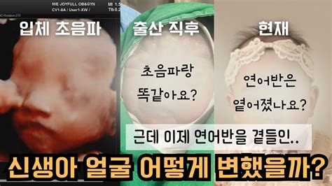신생아 얼굴 변화 기록 뱃속에서부터 입체초음파 8개월 현재까지 Feat 아기 연어반 Youtube