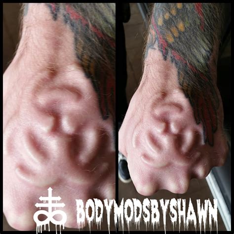 Silicone Body Modification Implants