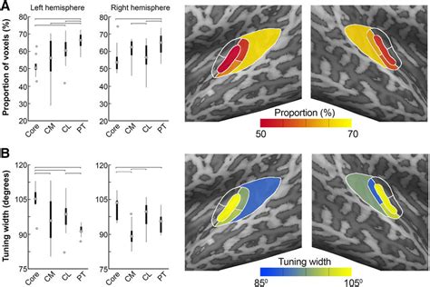 Spatial Selectivity Across Auditory Cortical Areas In Humans A Download Scientific Diagram