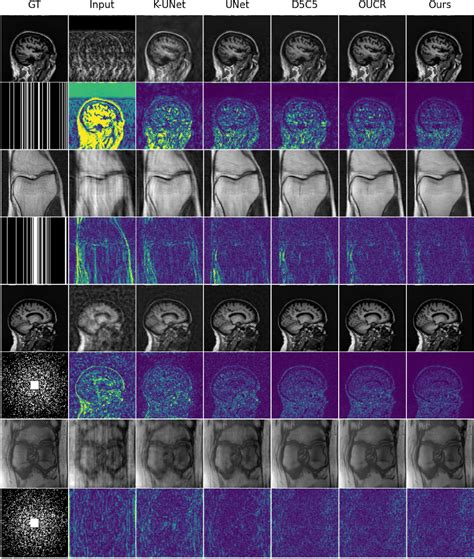 Figure 2 From K Space Transformer For Fast Mri Reconstruction With Implicit Representation