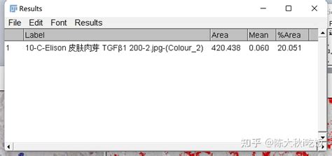 如何使用image J定量免疫组化阳性区域 知乎