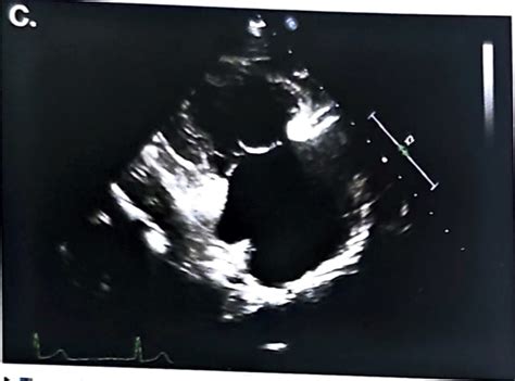 Rvit Diagram Quizlet