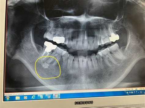 이빨 치과 진료 지식in
