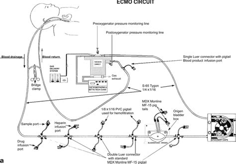 Vv Ecmo Circuit Extracorporeal Membrane Oxygenation Chapter 14