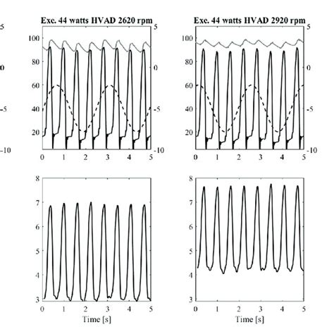 Echo Based Clinical Algorithm For Device Selection In Patients With Download Scientific Diagram