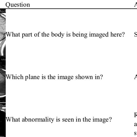 The Densenet 121 Architecture Download Scientific Diagram