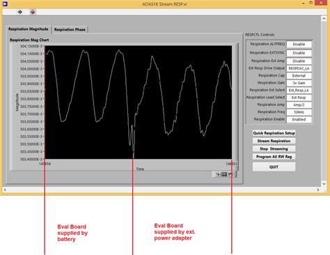 ADAS Distortion Of Respiration Signal When Using Ext Power