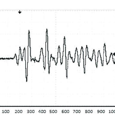 Transient Response At V Download Scientific Diagram
