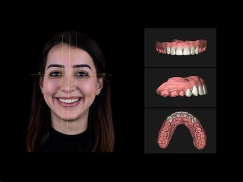 DTS D Detailed Tutorial YouTube