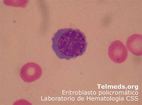 Hematologia Línea Eritroide Normal