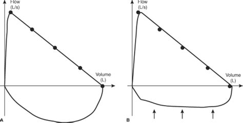 Multinodular Goiter Pathogenesis And Management Oncohema Key