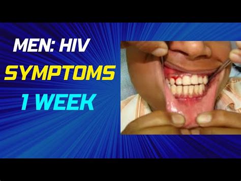 Hiv Symptoms In Men After 1 Week 1296b3