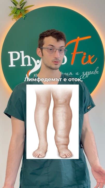 Какво е лимфедем здраве пловдив лимфедем лимфа оток българия Fyp Youtube