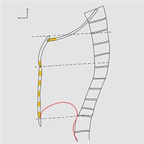 Diagramme De Schéma Mrta Rachis Quizlet