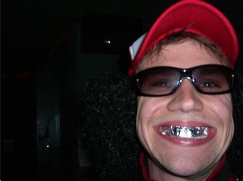 Bling Teeth 52 Pics