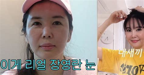 장영란 ★ 최초 성형 비포and애프터 공개 25년만 6번째 수술 고양이 눈 됐다a급 장영란 종합