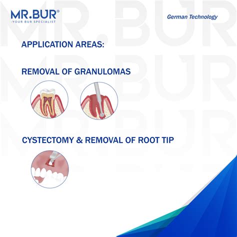 Best Degranulation Kit For Implantology Endodontic And Periodontal