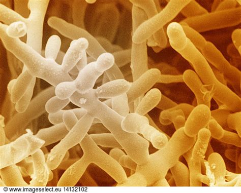 Trichophyton Tonsurans Trichophyton Tonsuransantibiotic