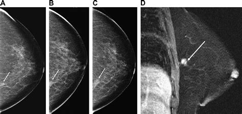Mr Imaging In The Evaluation Of Equivocal Clinical And Imaging Findings